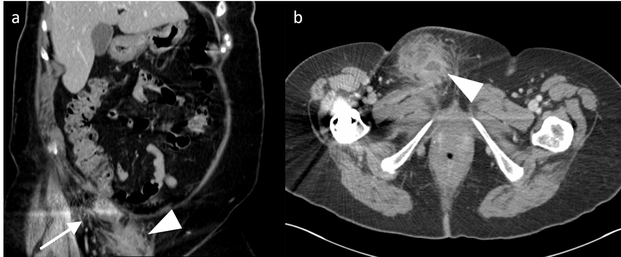 84-year-old woman with two-week history of enlarging painful right ...