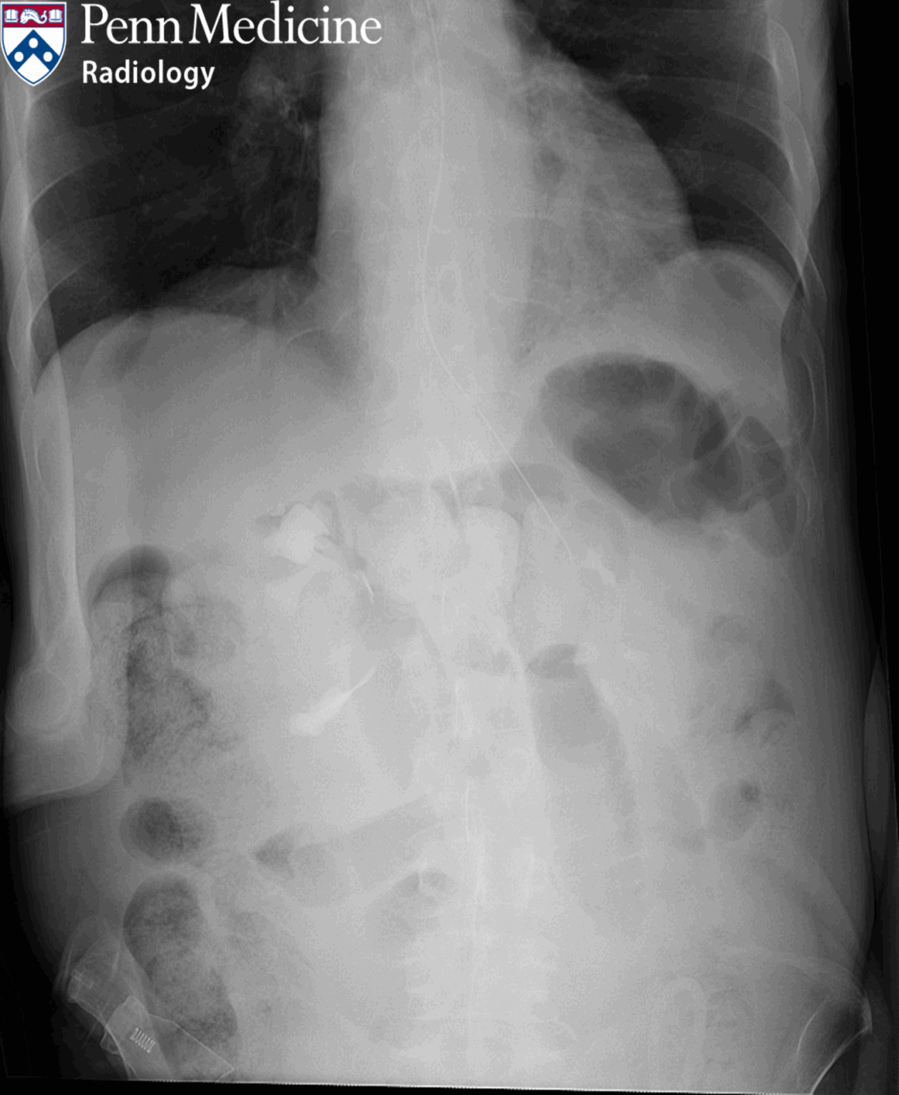 77-year-old man with abdominal pain and vomiting - myAuntminnie
