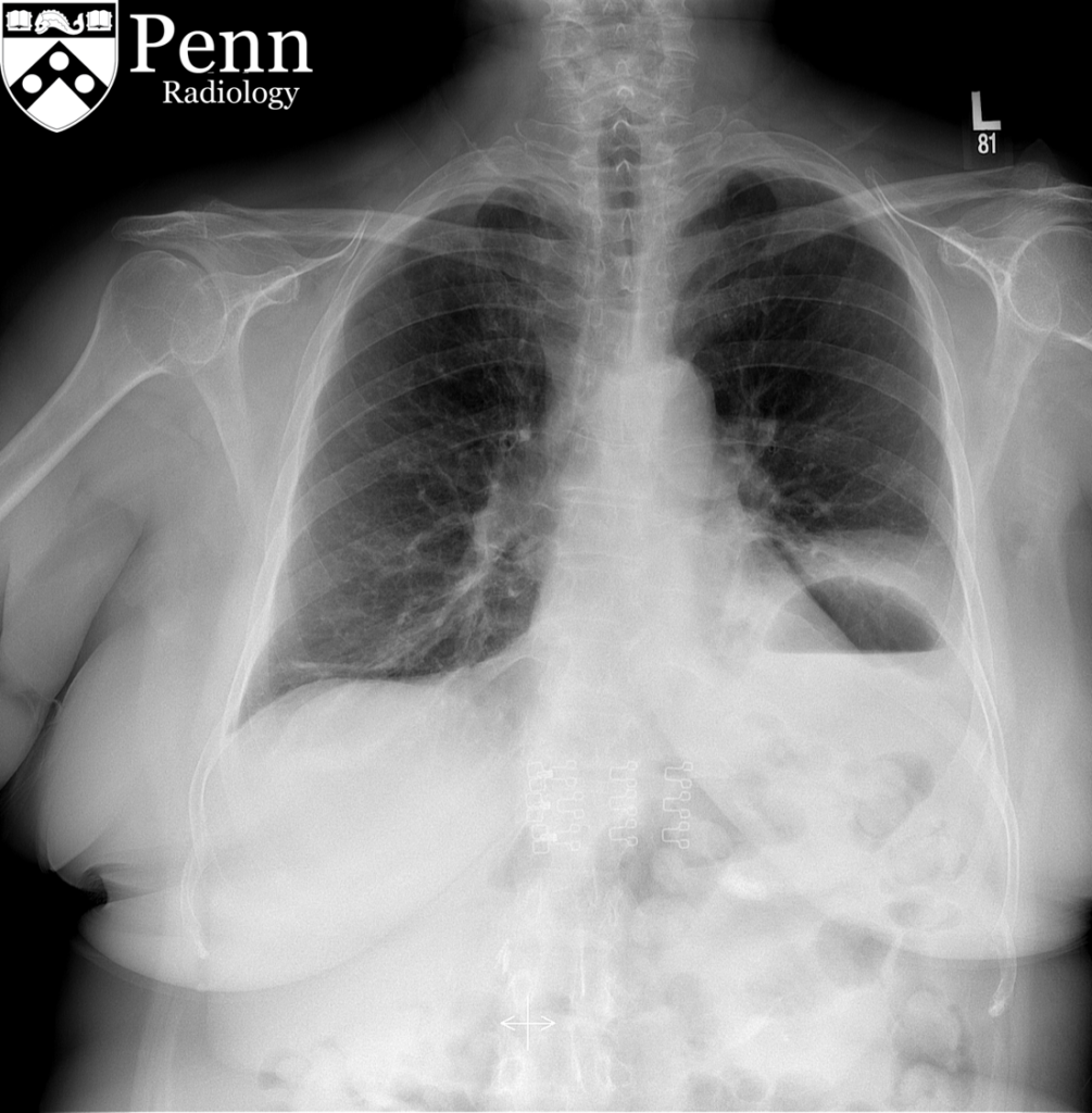 69-year-old woman with nausea, vomiting - Auntminnie