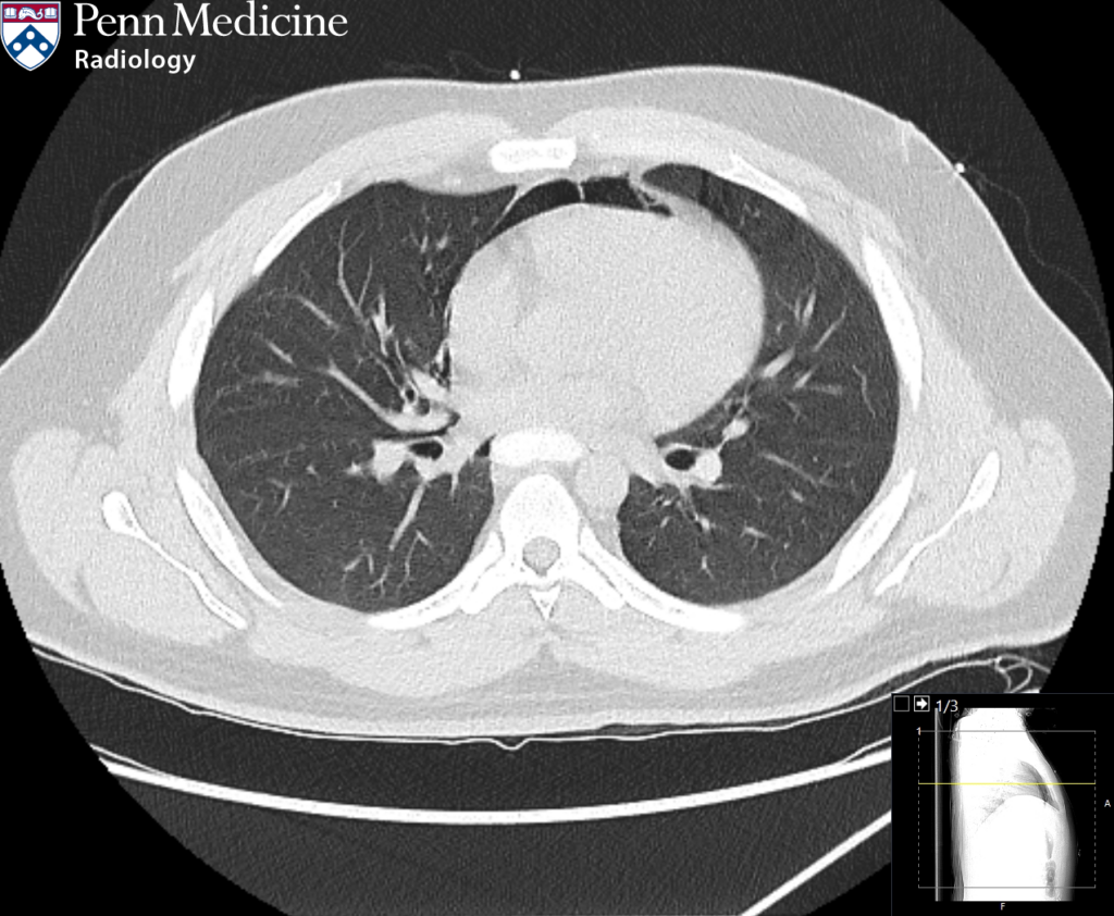 28-year-old man with nausea, shortness of breath - myAuntminnie
